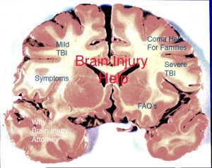 Four Basic Divisions of Brain